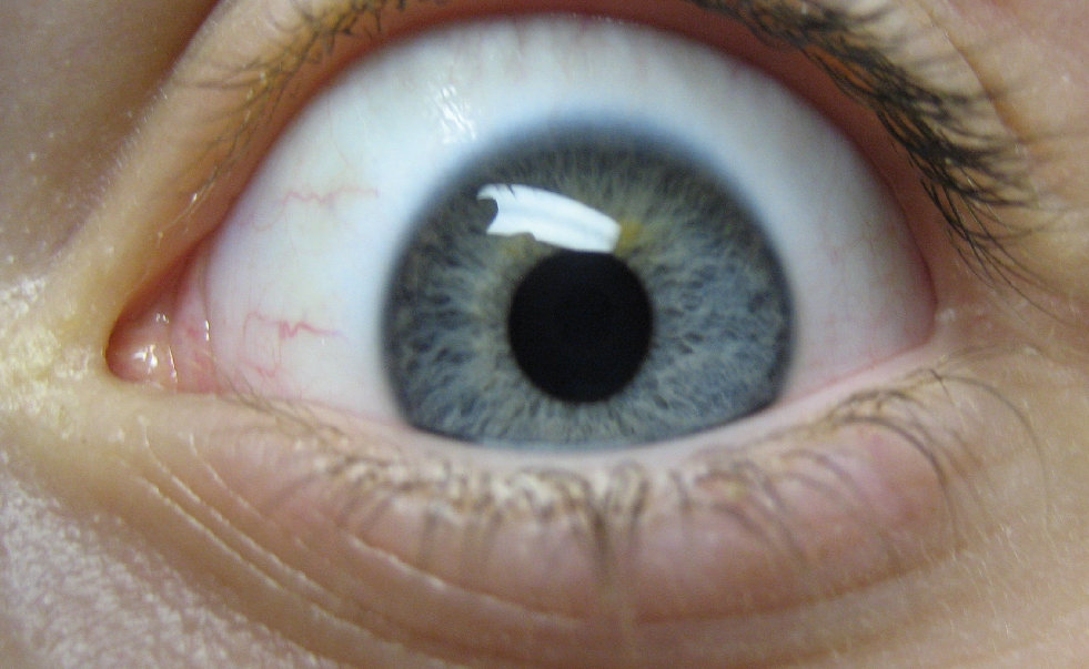 Tennis First Aid – Eye injury